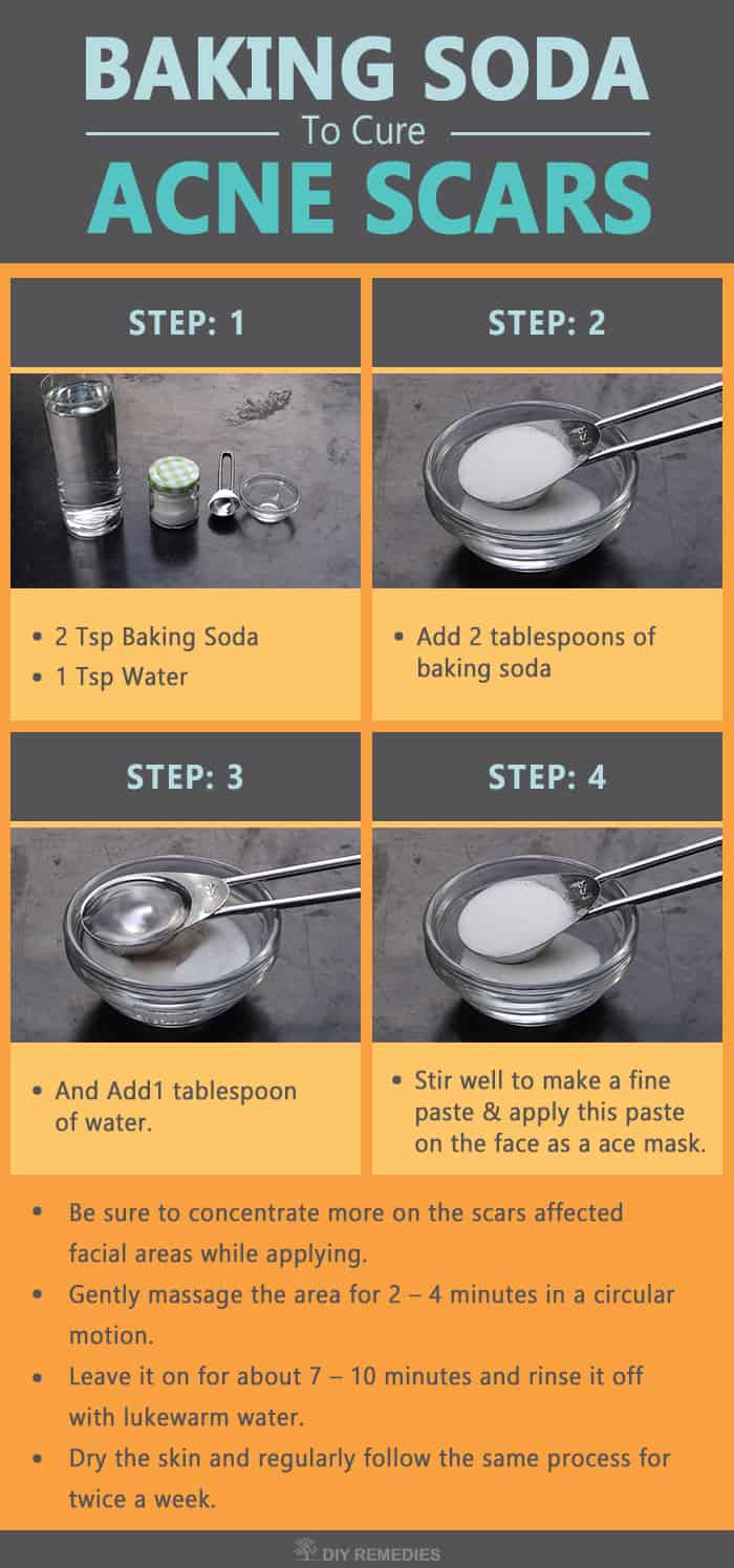 How to Get Rid of Acne Scars using Baking Soda