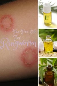 How to Apply Tea Tree Oil for Ringworm