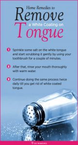 Natural Remedies to Get Rid of a White Coated Tongue