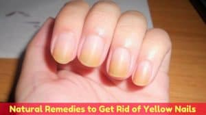 Natural Remedies to Get Rid of Yellow Nails