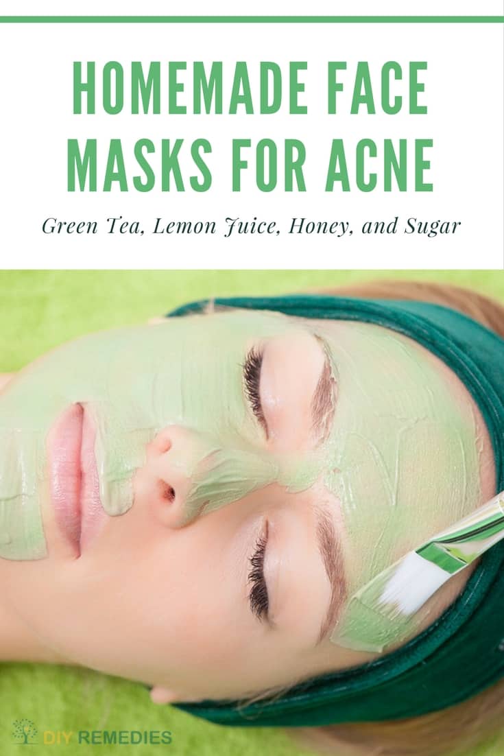 6 Best DIY Homemade Face Masks for Acne