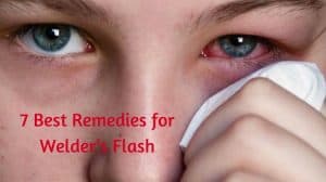 7 Best Remedies for Welder’s Flash