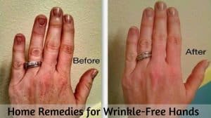 7 Best Remedies for Wrinkle-Free Hands
