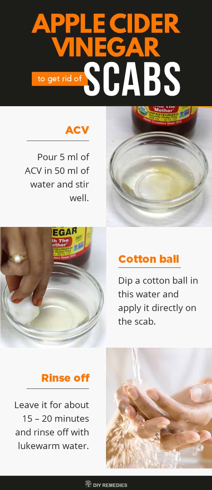 Natural Ways to Get Rid of Scabs