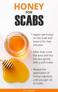 Natural Ways to Get Rid of Scabs