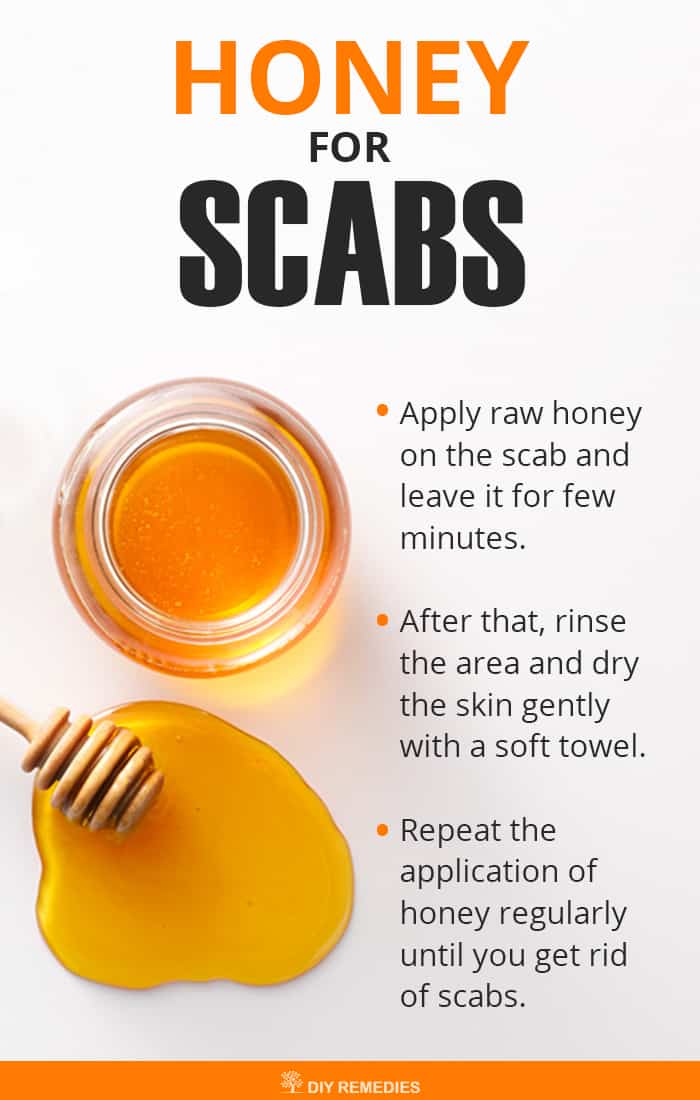 Natural Ways to Get Rid of Scabs